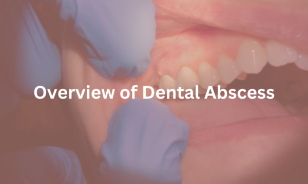 Overview of Dental Abscess: Causes and Treatments
