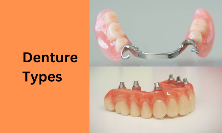 The Complete Guide to Different Types of Dentures