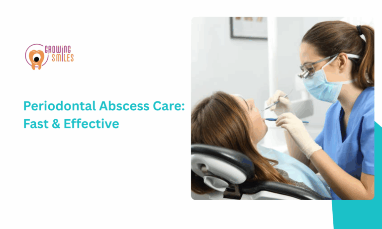 Periodontal Abscess Treatment for Fast and Effective Relief